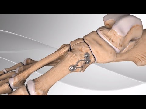 V. James Sammarco, MD | Orthopedic Surgeon Fairfield and Montgomery
