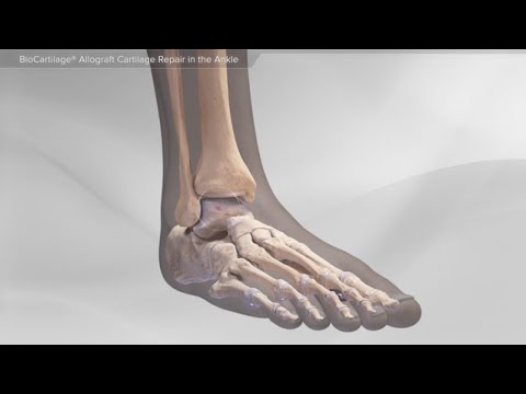 V. James Sammarco, MD | Orthopedic Surgeon Fairfield and Montgomery