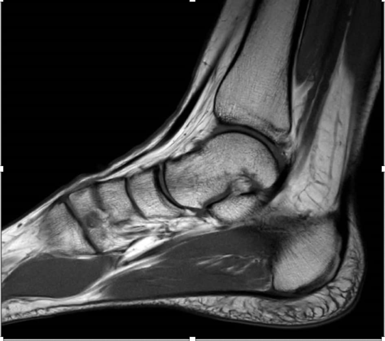 Imaging in Orthopedics: What’s the right image for you?