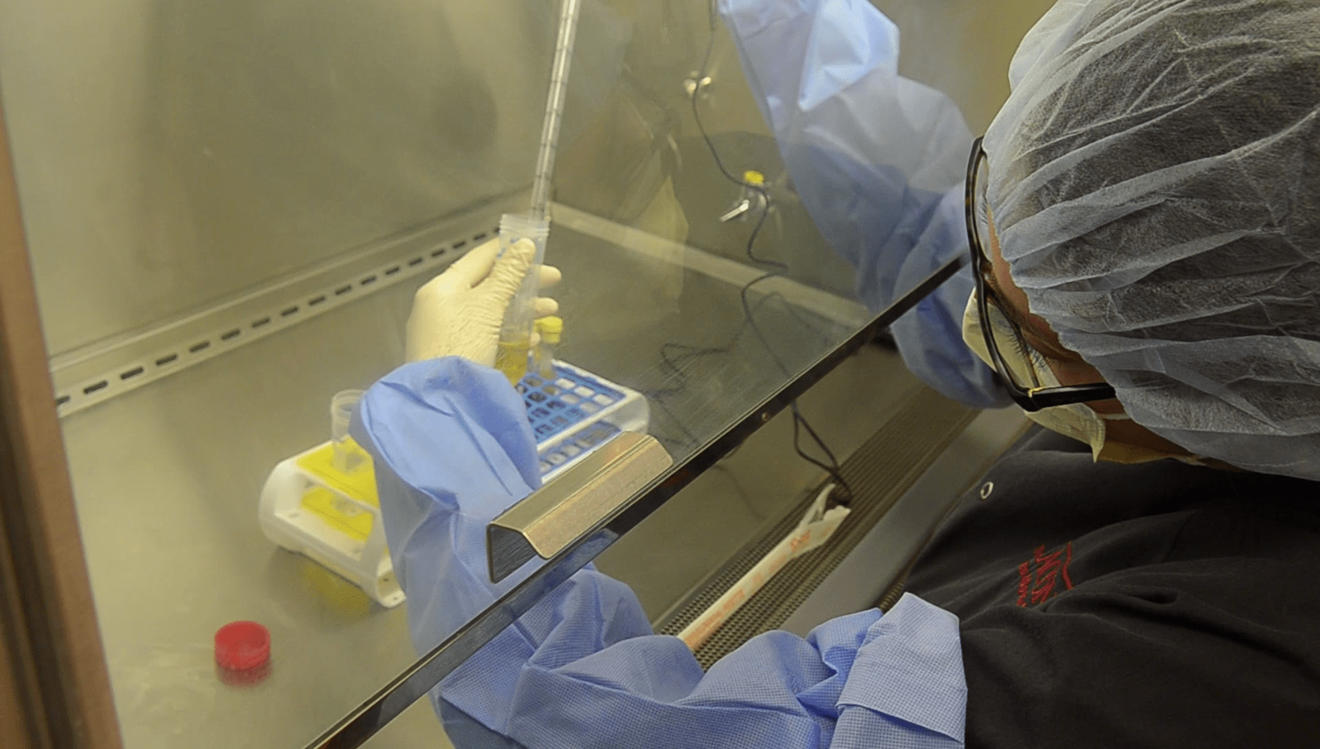 Interventional Orthopedics | Beacon Orthopaedics & Sports Medicine